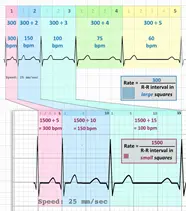 Approach To ECG CardioSchool